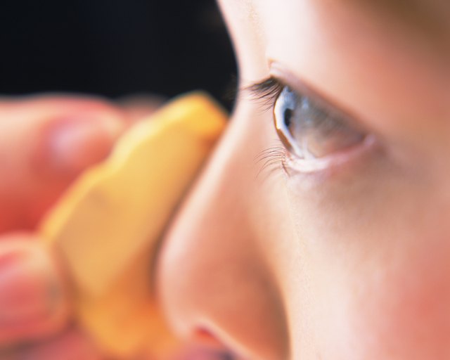 How To Remove Blue Veins In The Face Livestrong